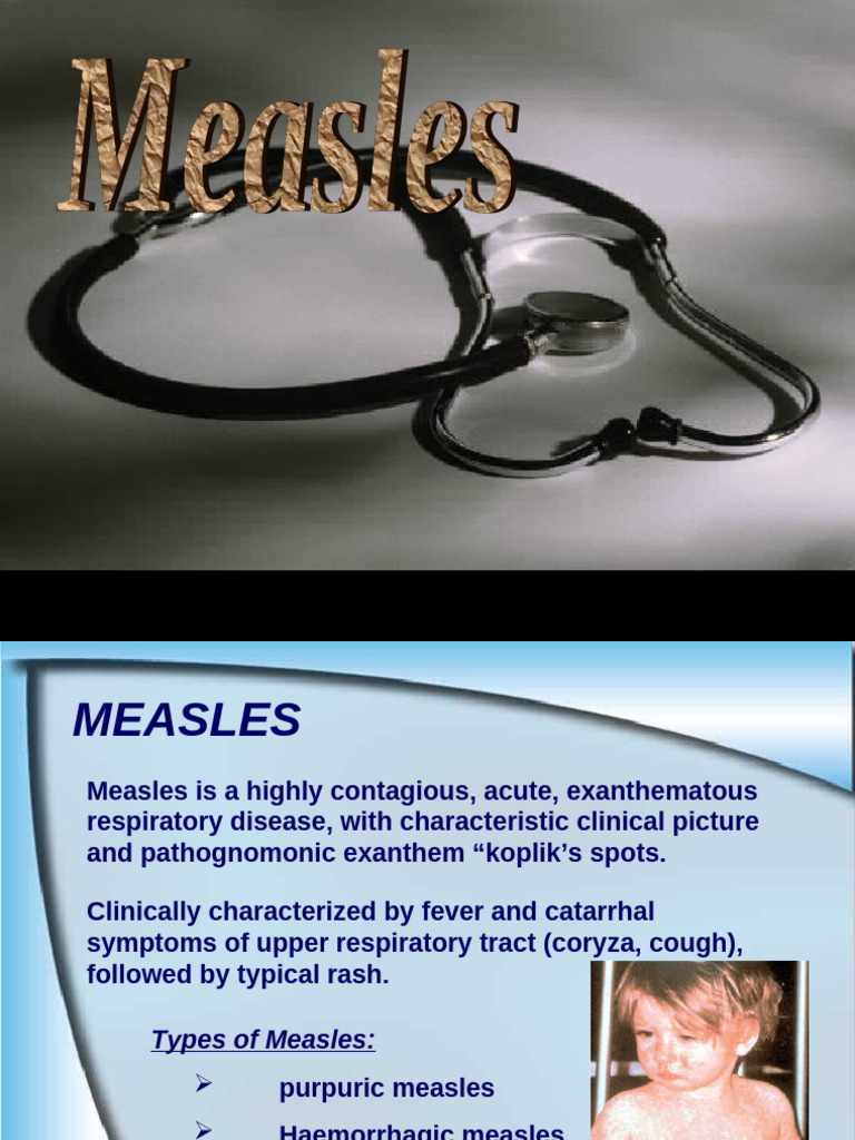 Understanding Measles: Causes and Impact | PDF | Measles | Infection