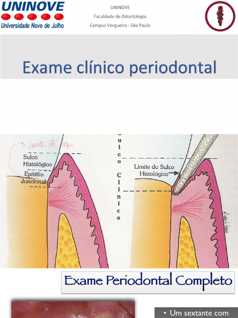 5 Lab Exame Clínico Periodontal Ii | PDF