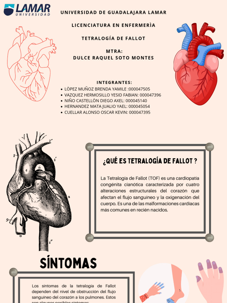 Tetralogía de Fallot: Síntomas y Tratamiento | PDF | Corazón | Hemodinámica