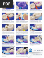 Dental Cementation Guide | PDF | Physical Sciences | Materials