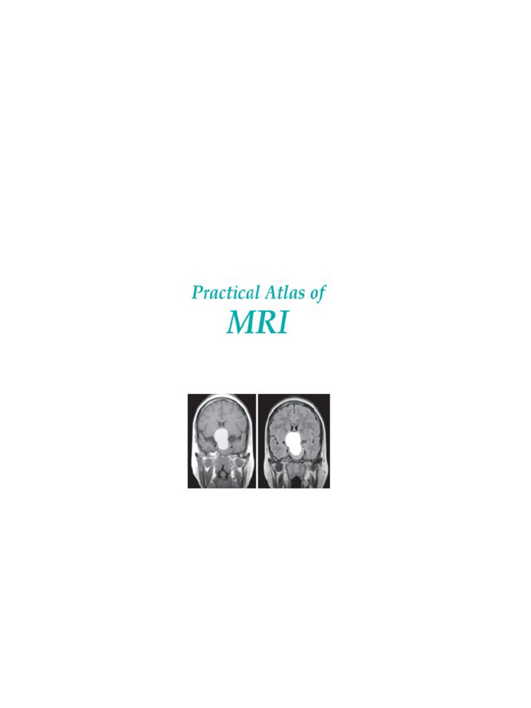 Practical Atlas of MRI 1st Edition Jagan Mohan Reddy PDF Download | PDF ...