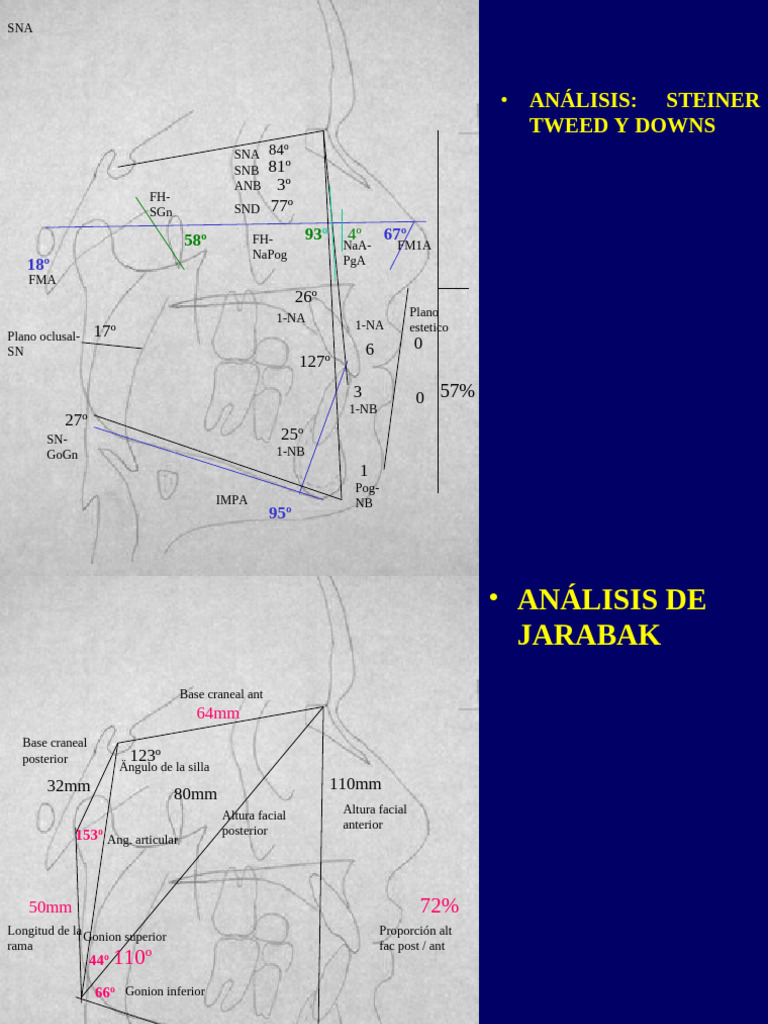 Análisis de Ángulos FMA y Gogn SN | PDF