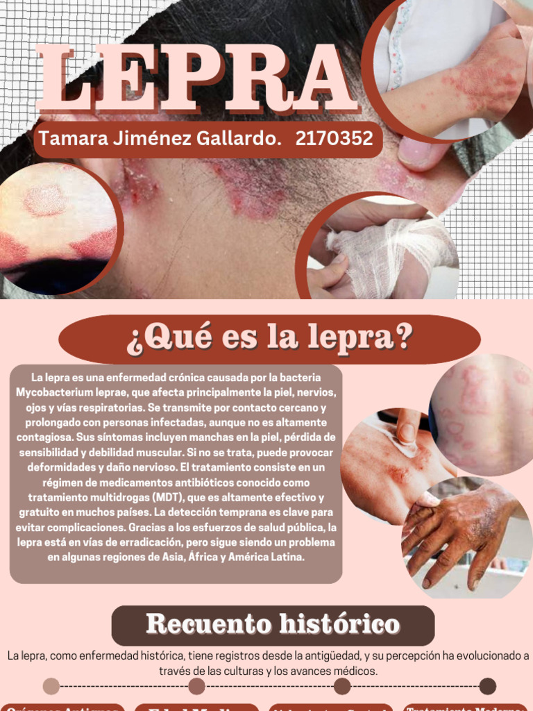 LEPRA.pdf | PDF | Lepra | Asistencia sanitaria preventiva