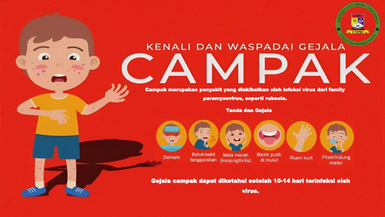Poster Campak | PDF