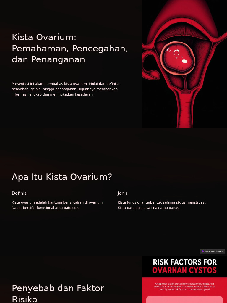Kista Ovarium: Gejala, Penyebab, dan Penanganan | PDF