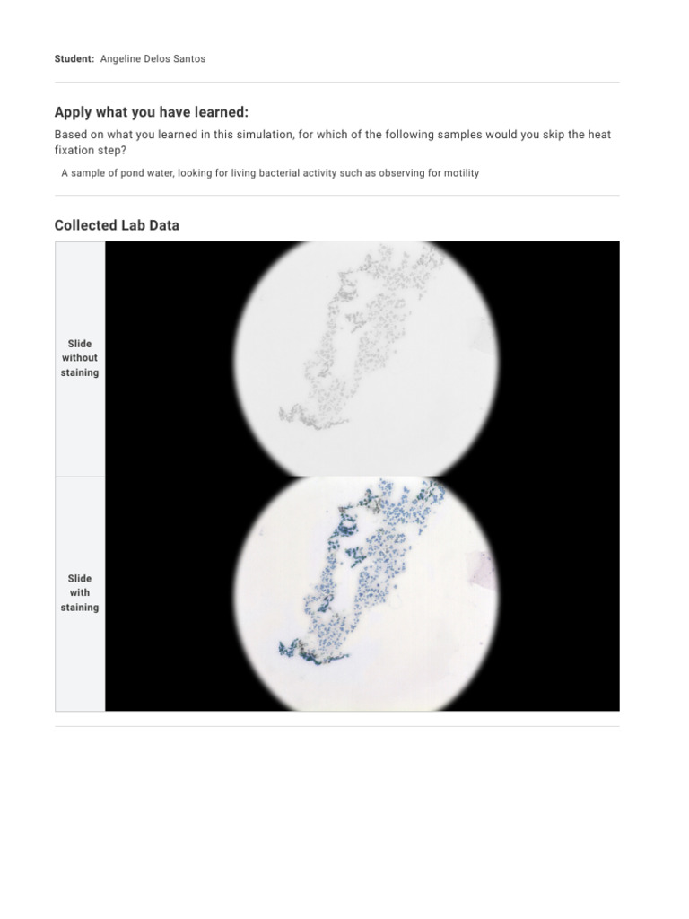 Preparing A Smear Sample | PDF