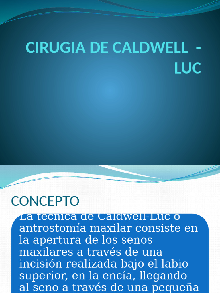 Técnica Quirúrgica de Caldwell-Luc | PDF
