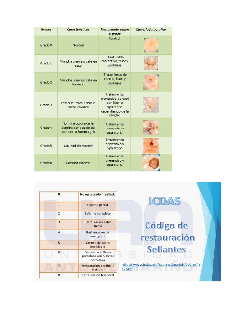 ICDAS | PDF