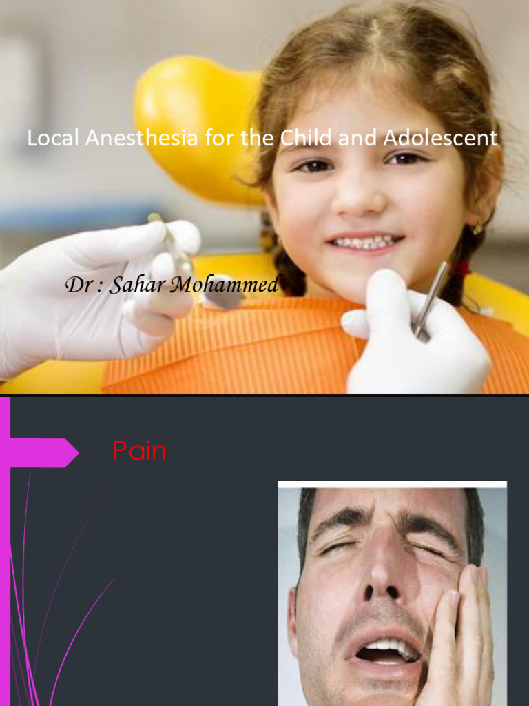 Local Anesthesia in Pediatric Dentistry | PDF | Anesthesia | Injection ...