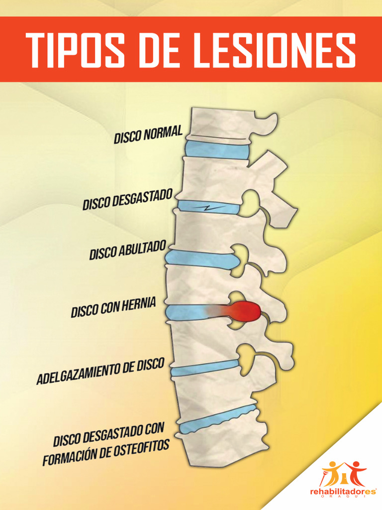 Tipos de Lesiones | PDF