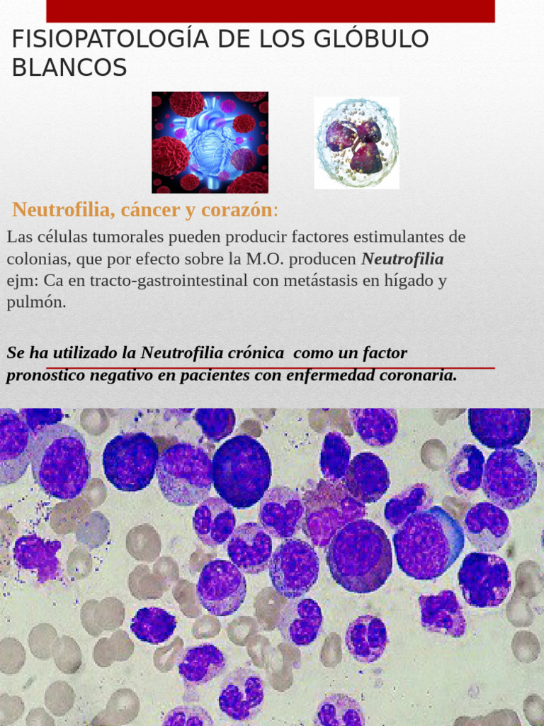 Fisiopatología de Los Glóbulo Blancos Angelo | PDF