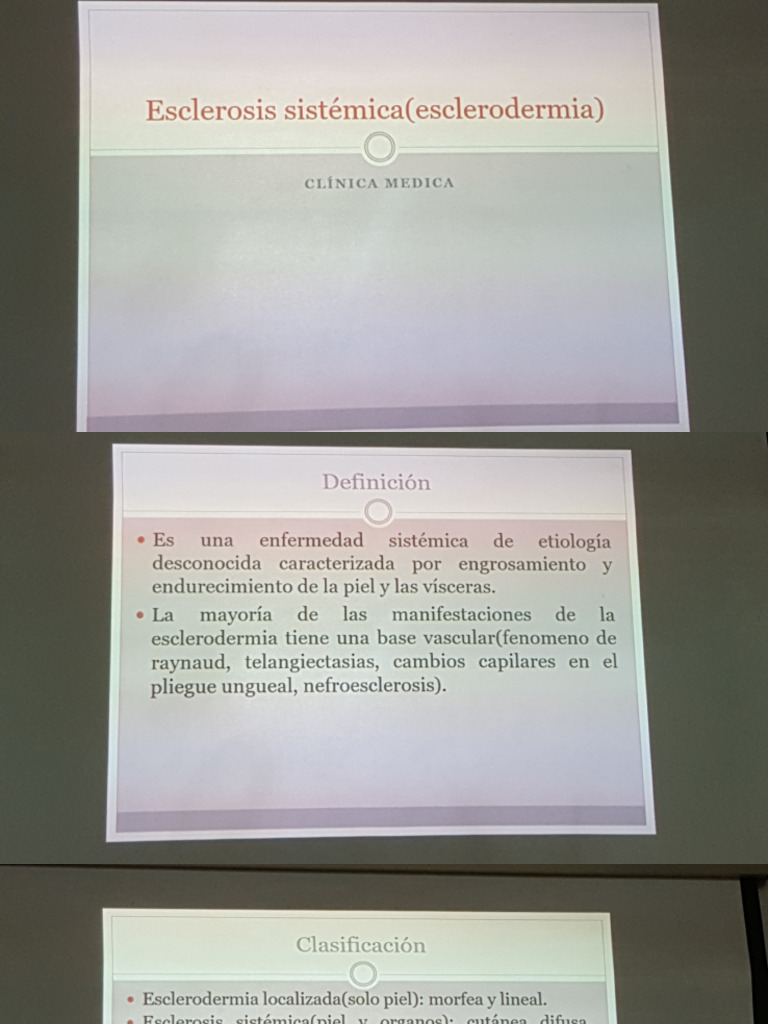 2 Esclerodermia | PDF