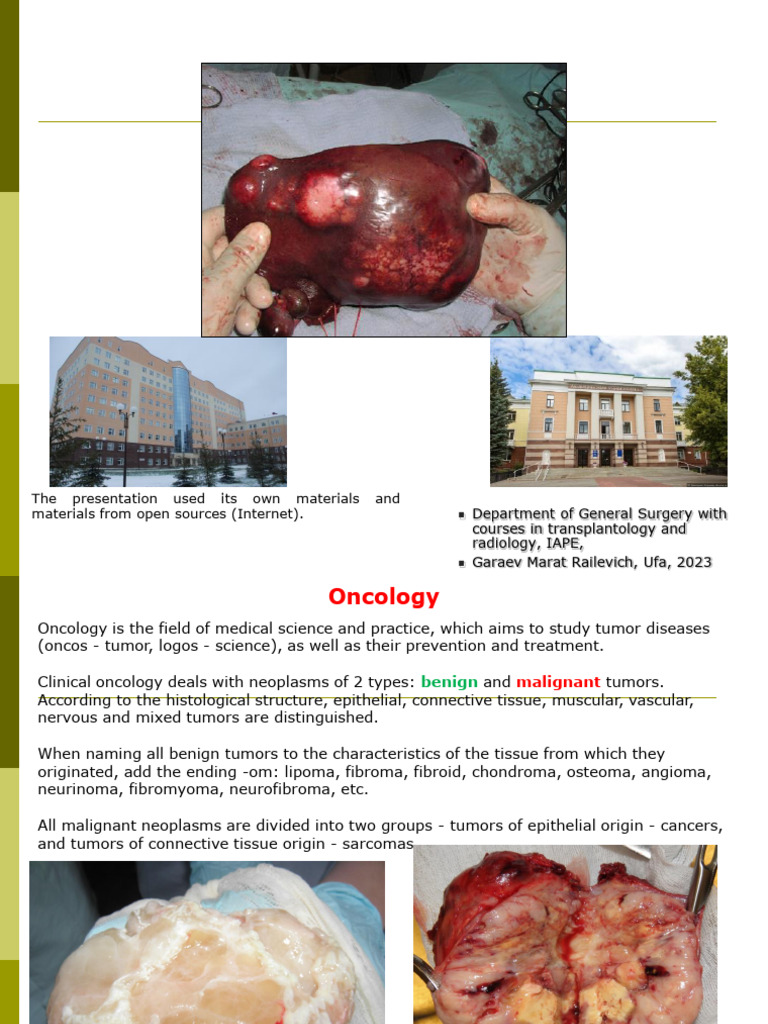 Tumors. Fundamentals of Surgical Oncology. Developmental Defects ...