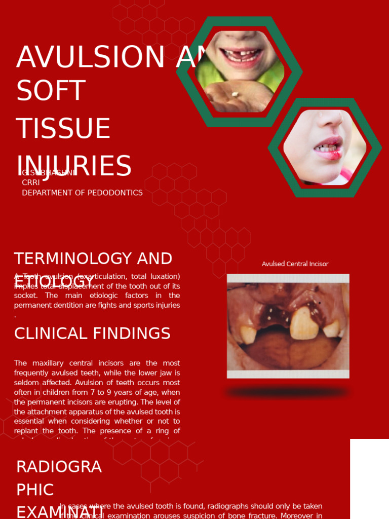 Avulsion Soft Tissue Injury | PDF | Surgical Suture | Human Tooth