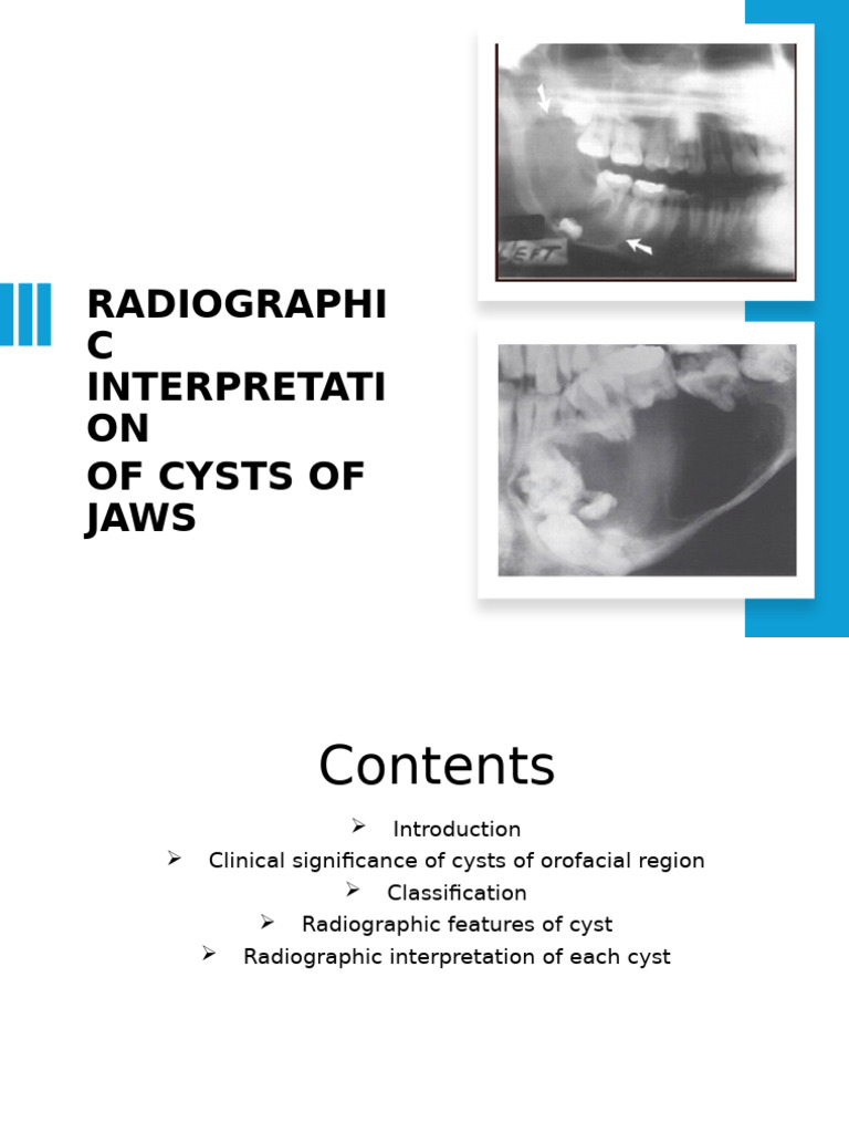radiographic interpretation | PDF | Epithelium | Tooth