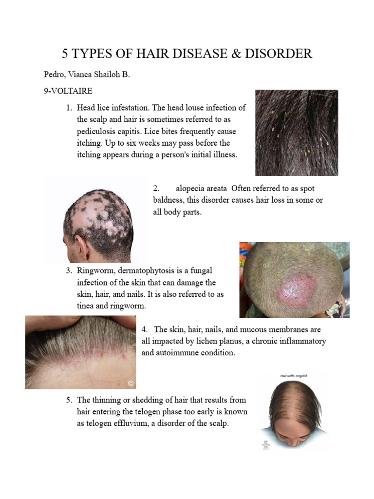 5 Types of Hair Disease&Disorder | PDF