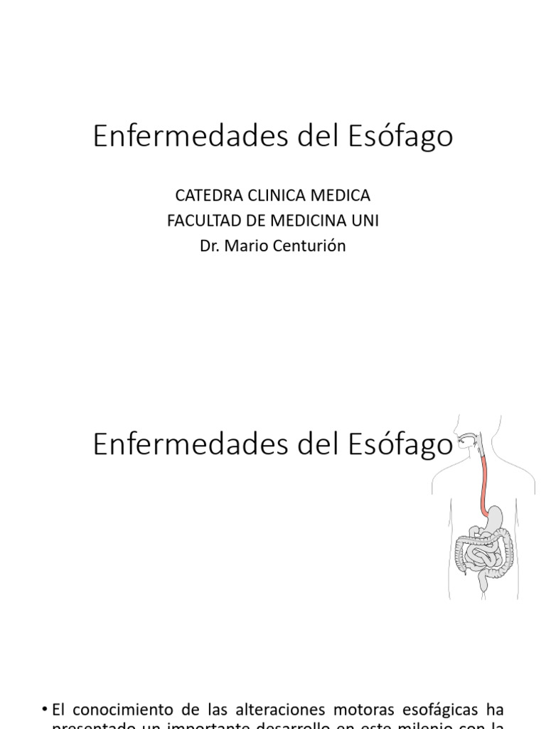 Enfermedades Del Esófago | PDF | La enfermedad por reflujo ...