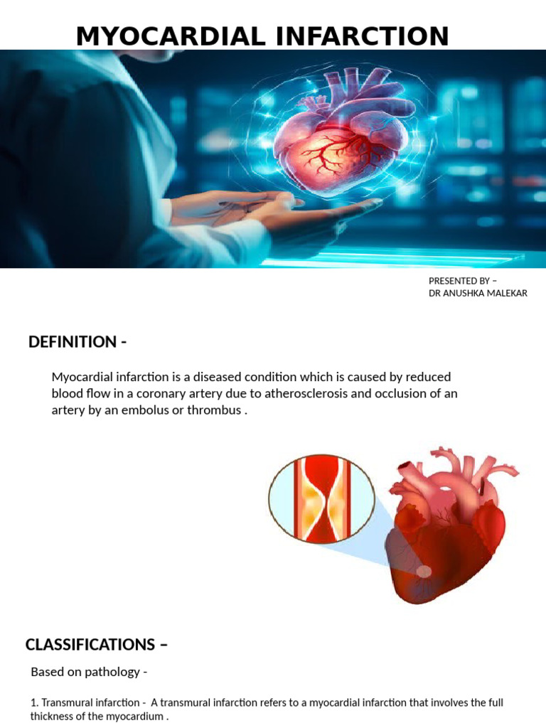 MYOCARDIAL INFARCTION | PDF | Coronary Circulation | Myocardial Infarction