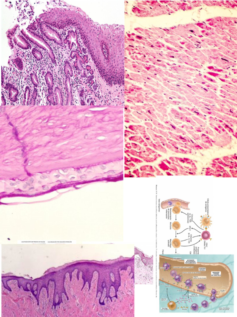 Hiperplasia | PDF