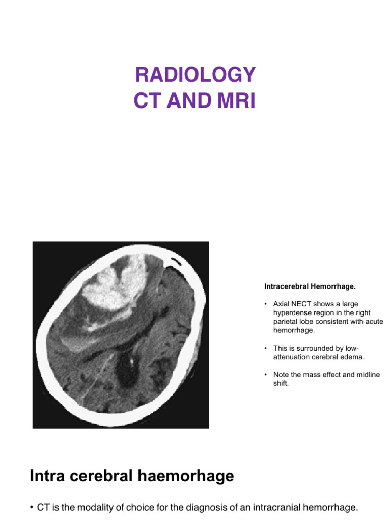 CT - Mri 2 | PDF