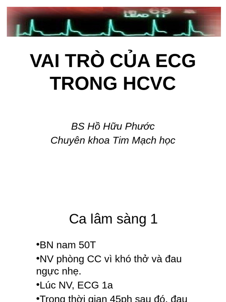 Vai Trò C A Ecg Trong HCVC 2.0 | PDF