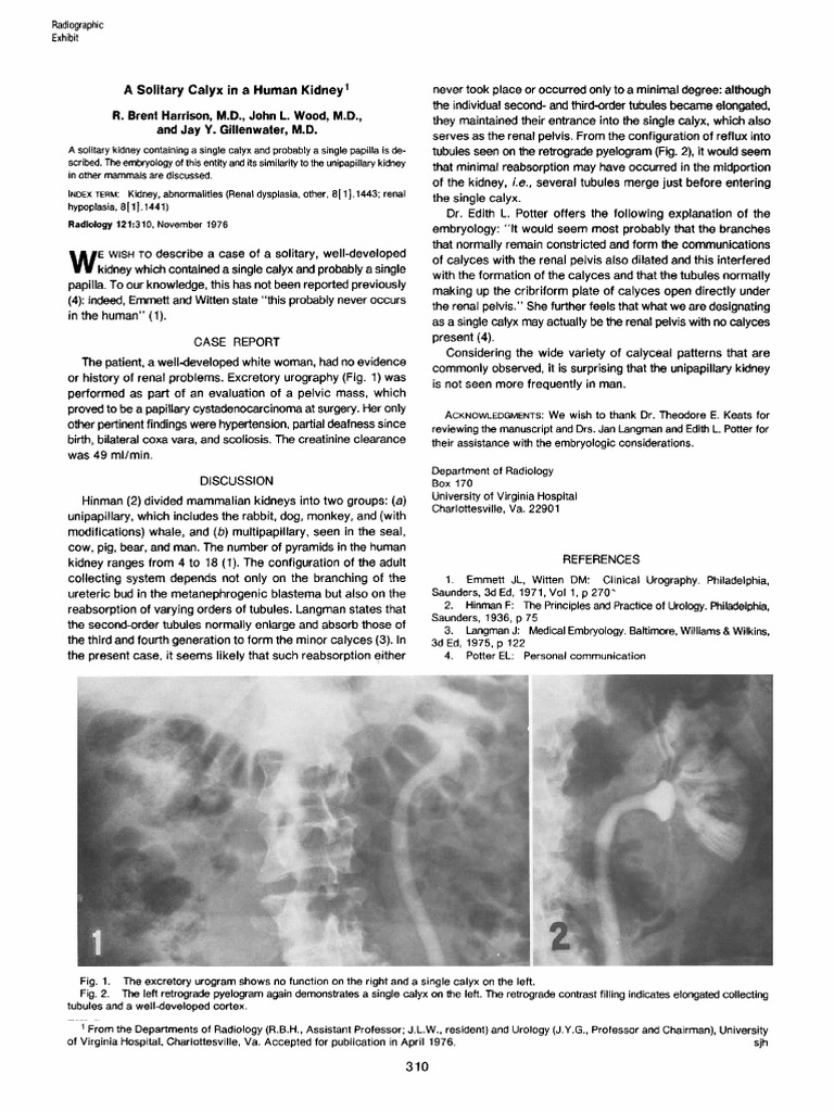 Unipapillary Kidney Case Report | PDF | Kidney | Urinary System