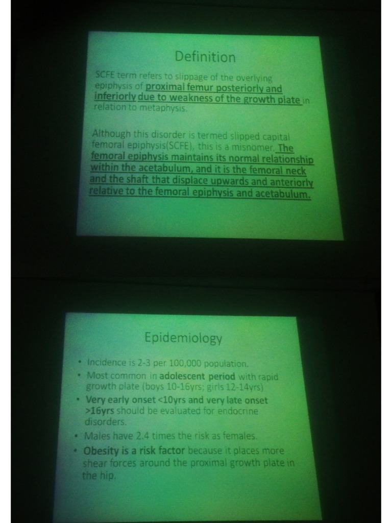 Slipped Capital Femoral Epiphysis (SCFE) | PDF