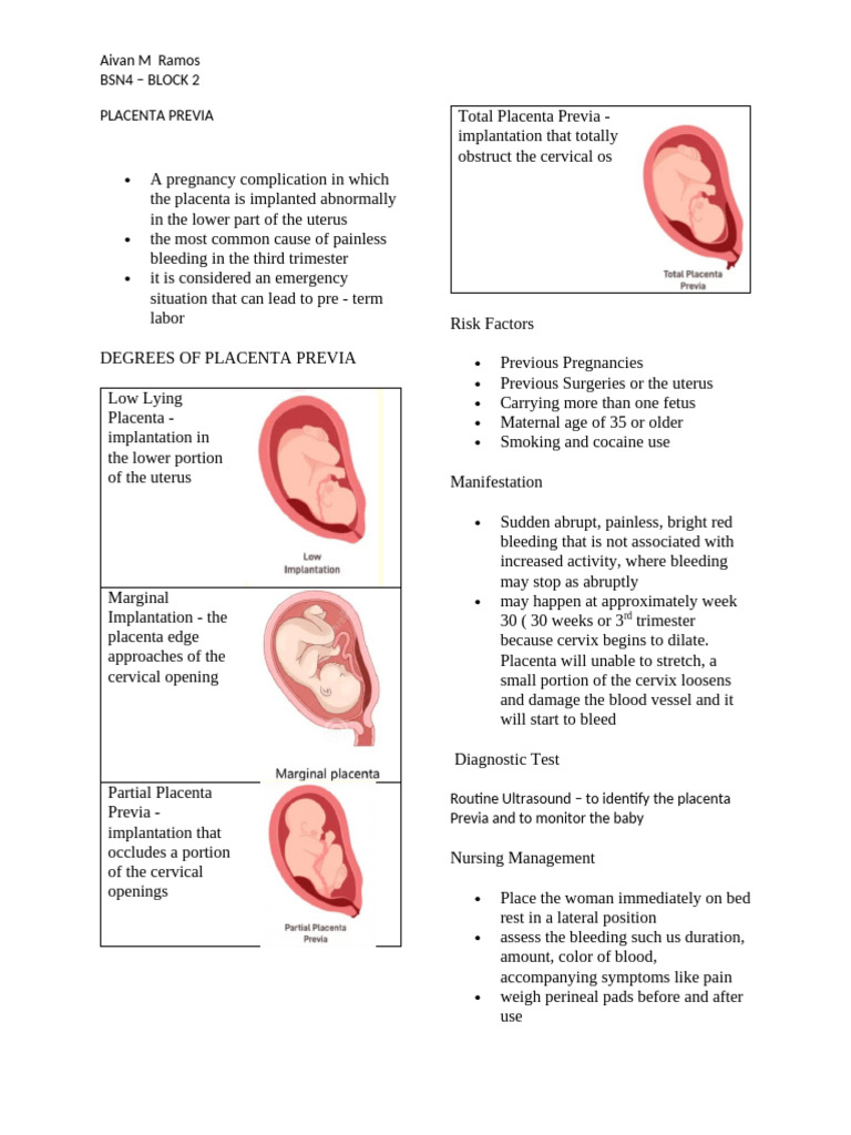 Placenta Previa | PDF | Pregnancy | Placenta