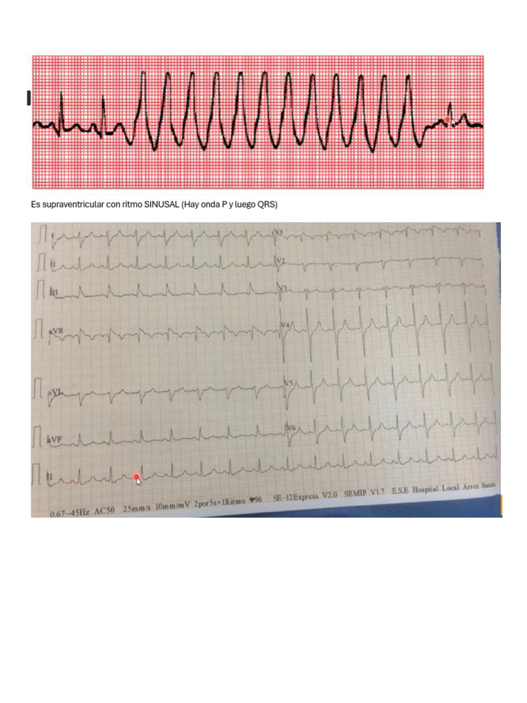Resumen medicina interna cinco | PDF