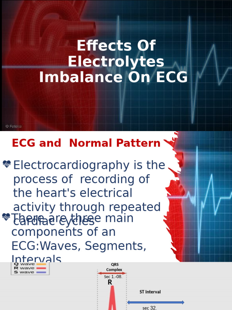 Effects of Electrolytes Imbalance On ECG (Finaaaal Edit) | PDF ...