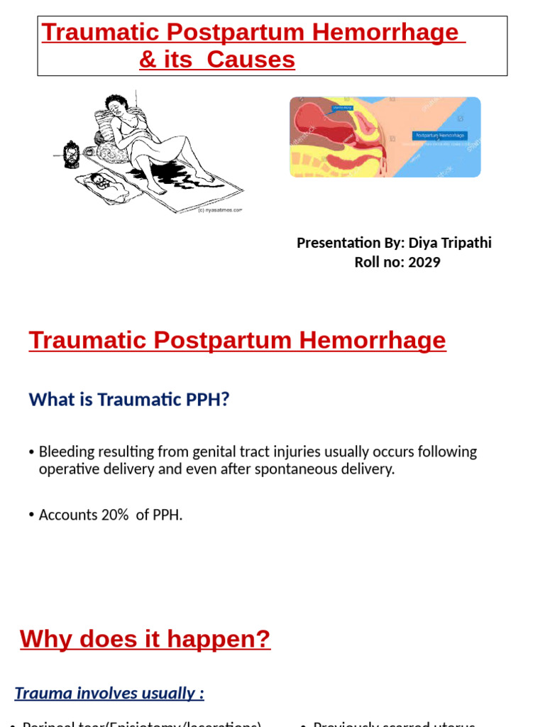 Traumatic Postpartum Hemorrhage Overview | PDF