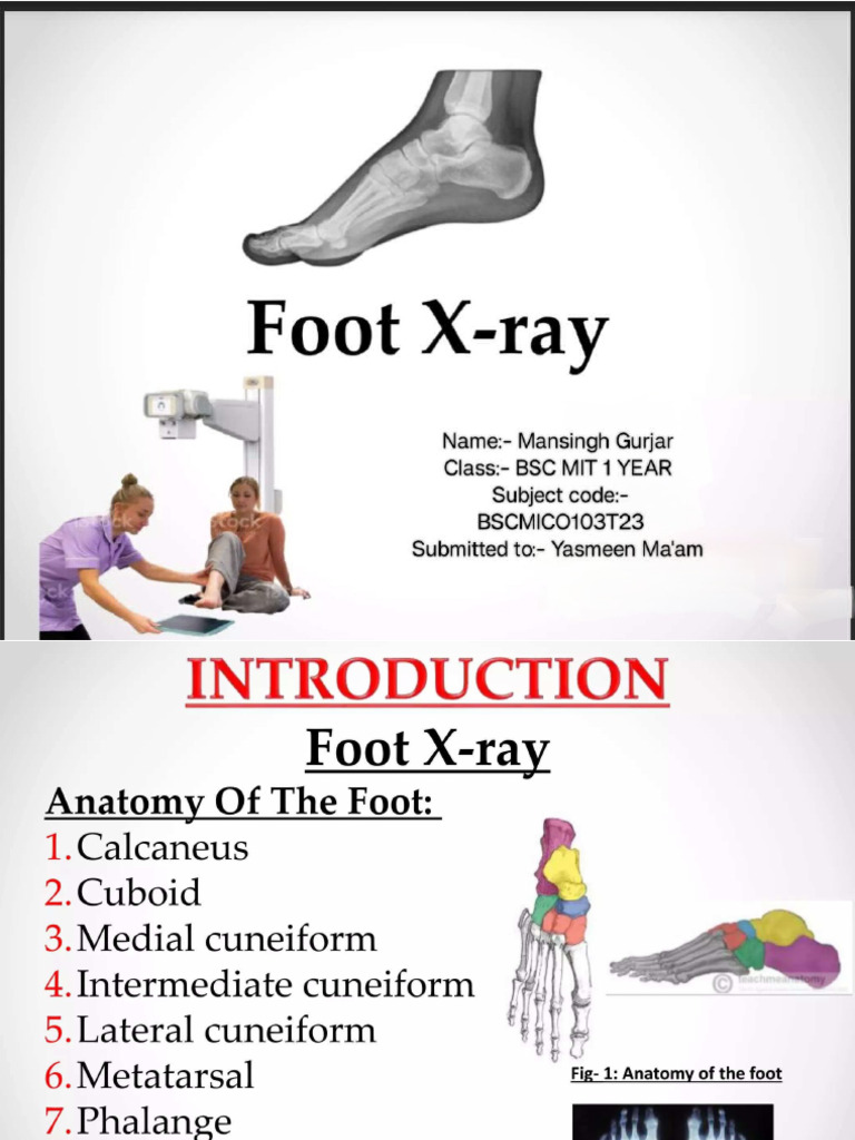 Foot Radiography | PDF