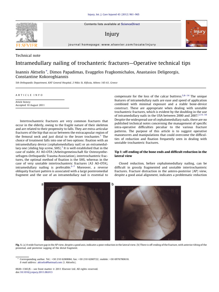 IMN INTERTROCH - TIPS AND TRICKS of Technique - Aktselis - Injury 2012 ...