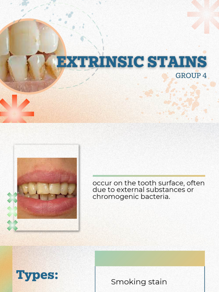 Group-4_-Extrinsic-Stains | PDF