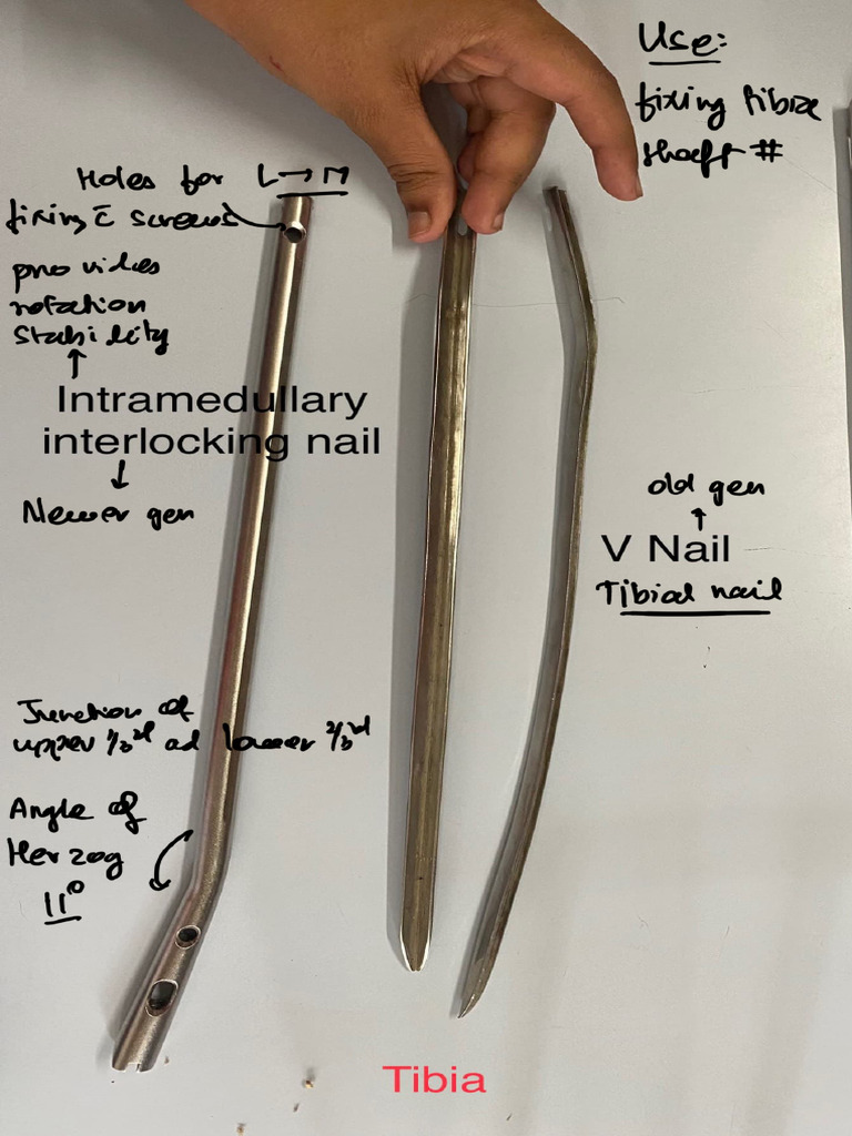Instruments Ortho | PDF