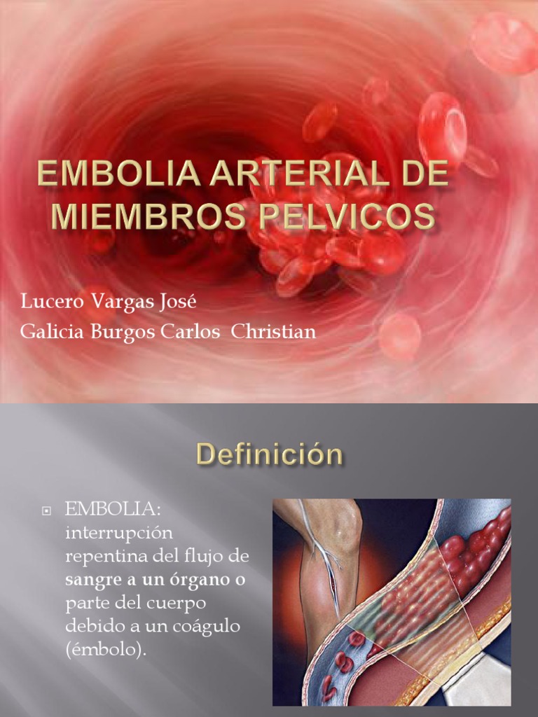 Embolia Arterial de Miembros Pelvicos 2010 | PDF | Embolia | Trombo