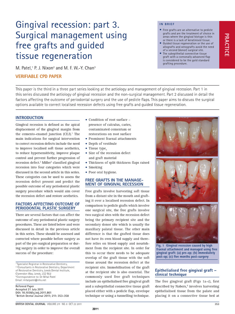 Gingival Recession Part 3. Surgical Management Using Free Grafts and ...
