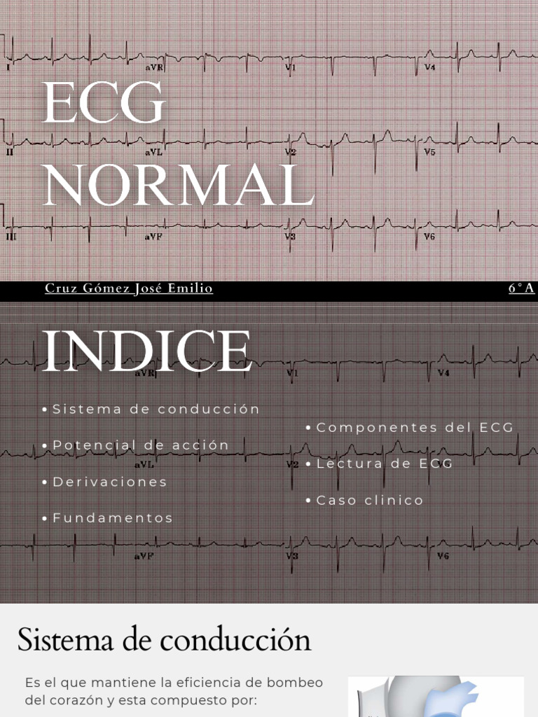 Fundamentos y Lectura del ECG | PDF | Potencial de acción ...
