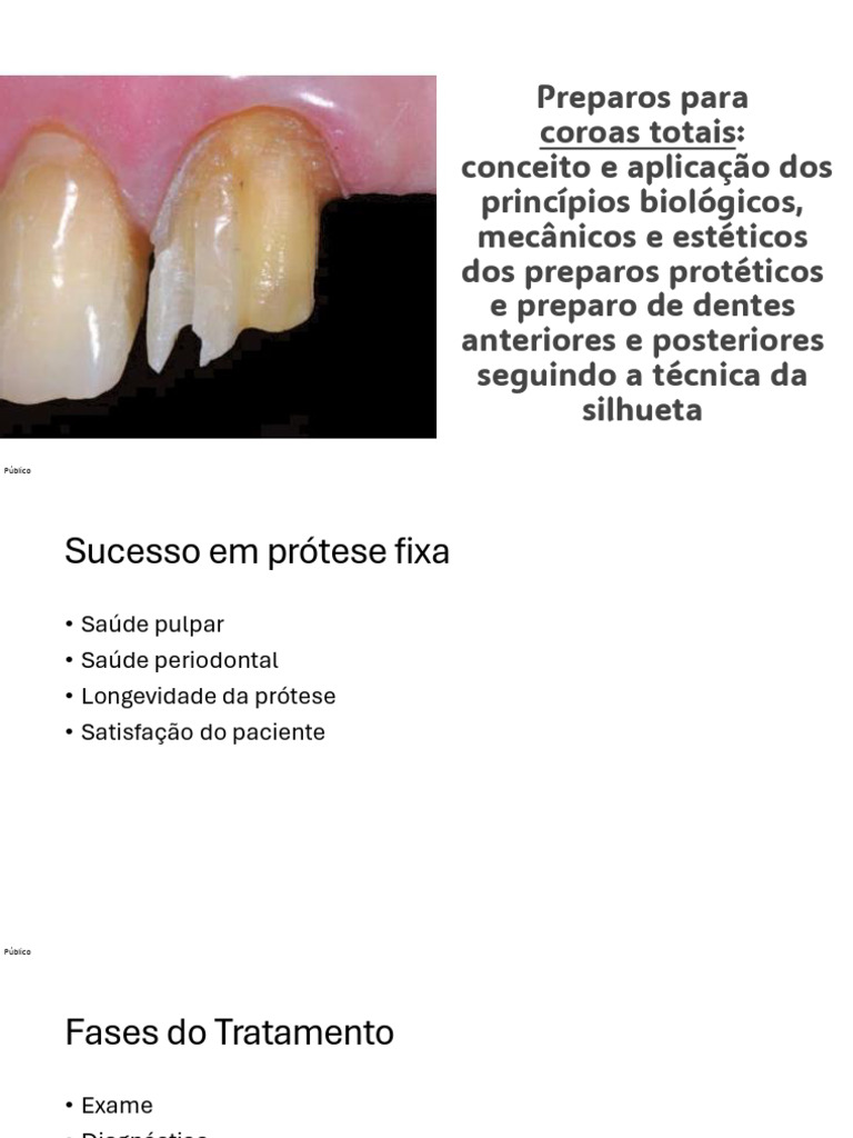 Preparo para Coroa em Dentes Anteriores e Posteriores | PDF | Prótese ...