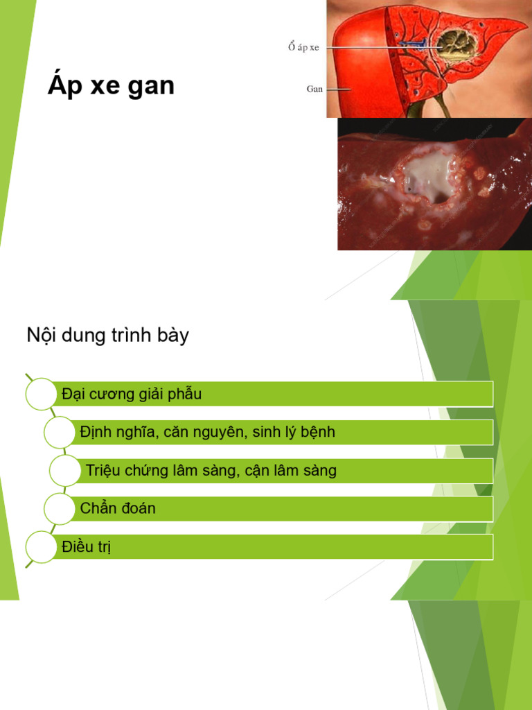LEC 12 - Áp Xe Gan | PDF