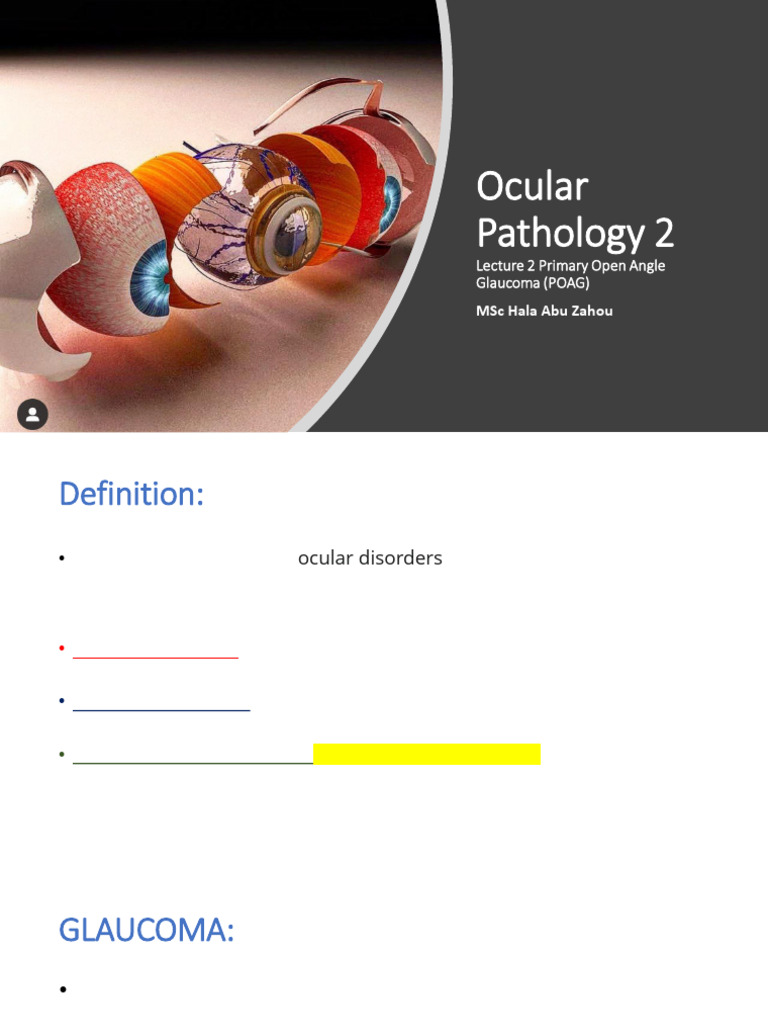 OP2 Open Angle Glaucoma | PDF | Glaucoma | Senses