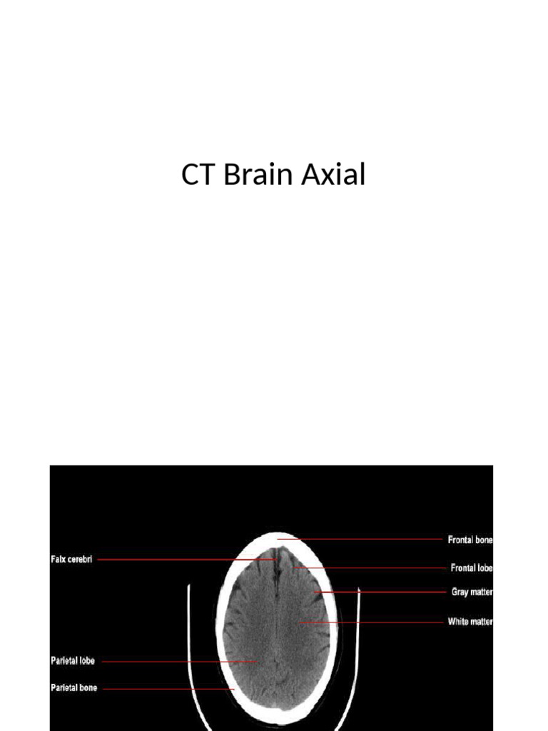 CT Brain Axial | PDF