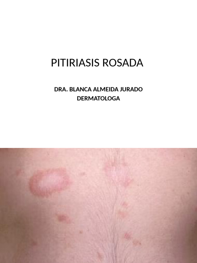 Pitiriasis Rosada y Molusco Contagioso | PDF | Virus | Infección