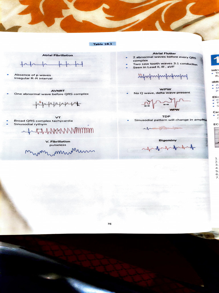 Different ECG | PDF