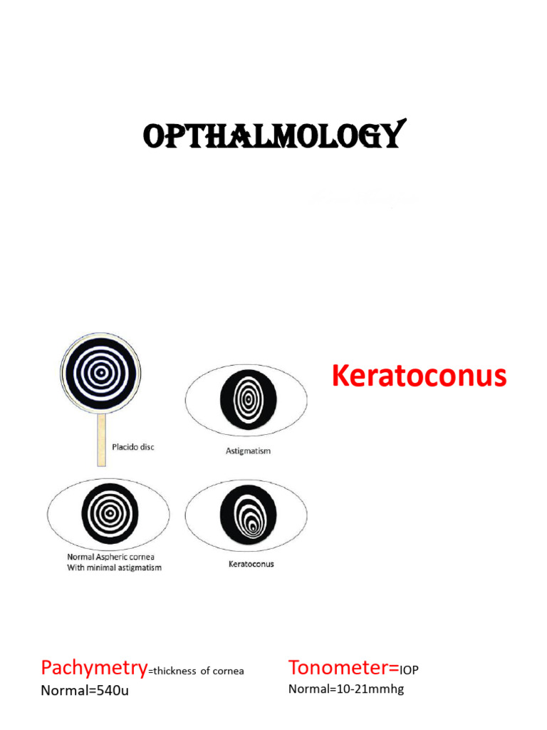 Optha Images Repeated | PDF | Cataract | Glaucoma