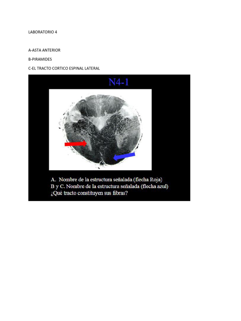 Preguntas Del Parcial de Neuro 2 | PDF | Cerebelo | Sistema nervioso central