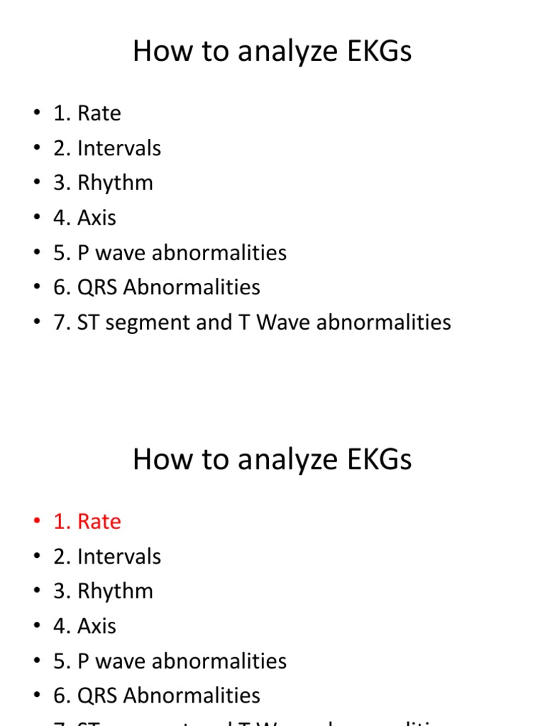 How To Analyze Ekgs | PDF | Electrocardiography | Cardiovascular Diseases