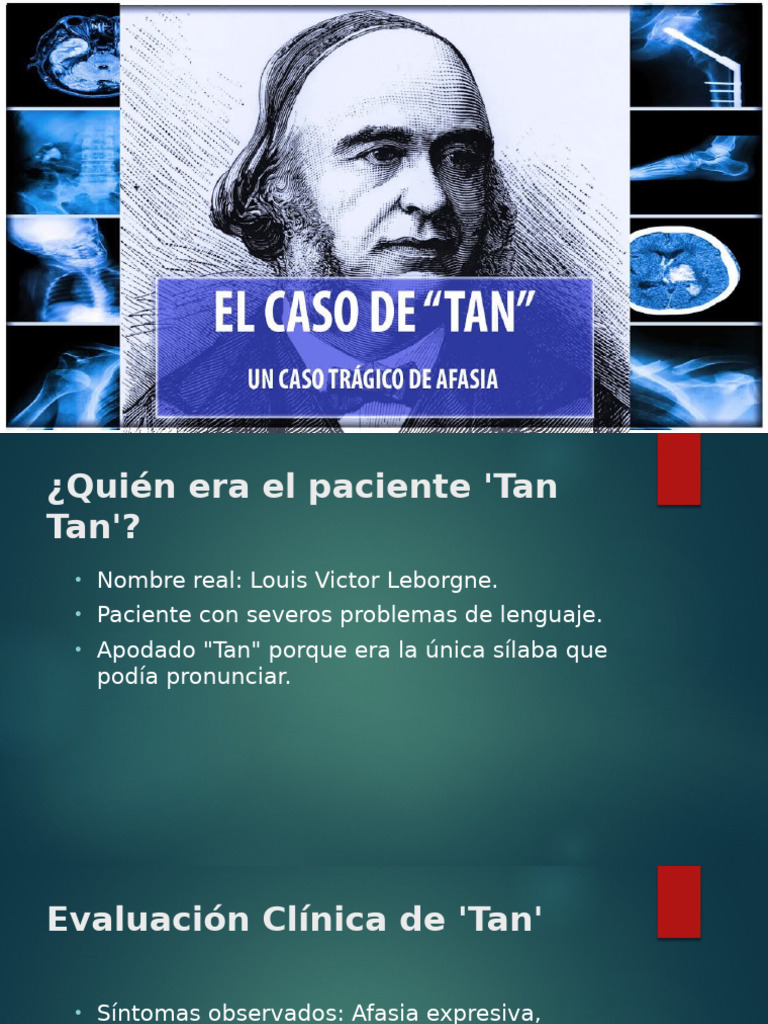 Area de Broca | PDF