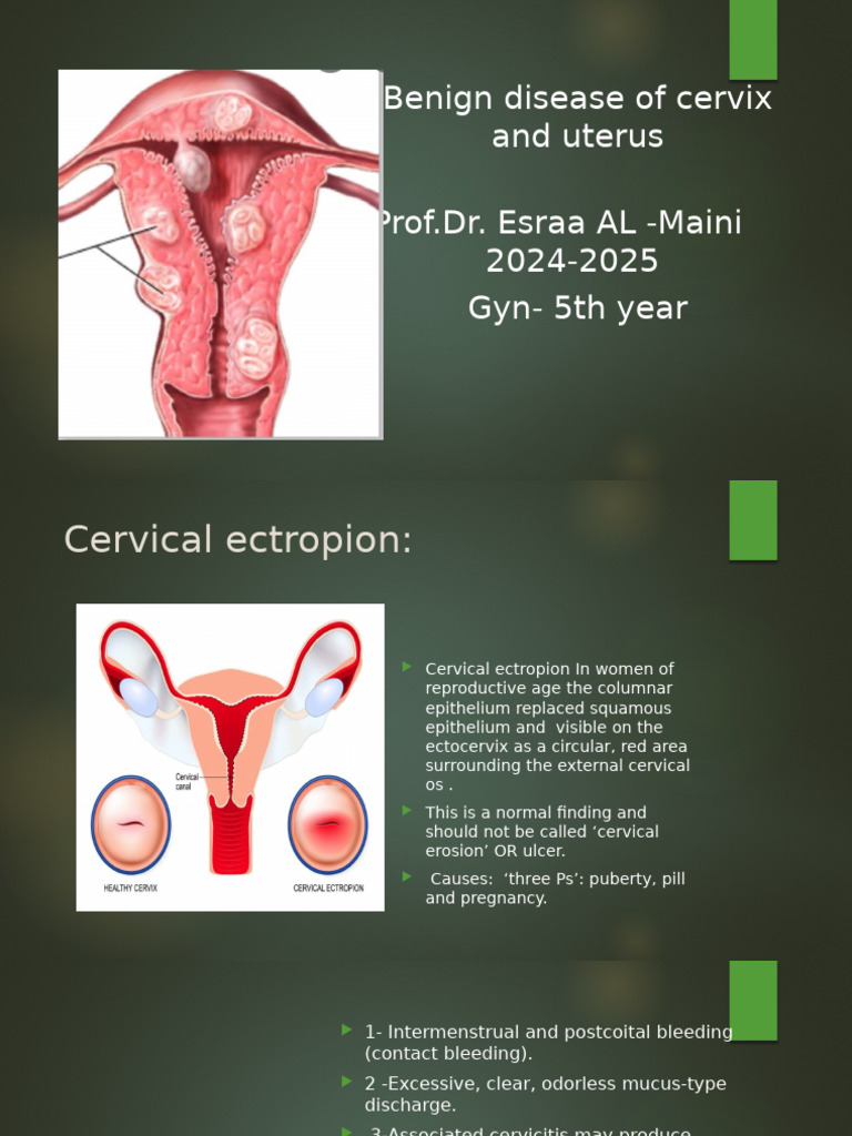 Benign Disease of Uterus | PDF | Women's Health | Sexual Anatomy