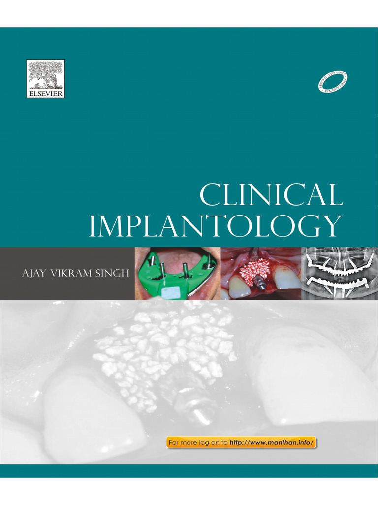 ##8. Ajay Vikram Singh Clinical Implantology | PDF